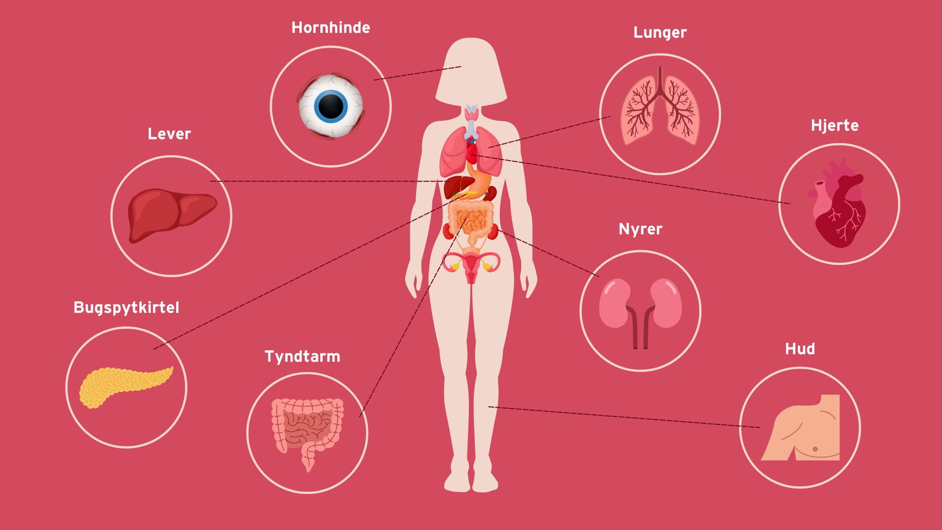 Sådan foregår en organdonation
